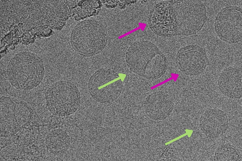 Direct Imaging of Payload Distribution of DNA and RNA in Lipid Nanoparticles